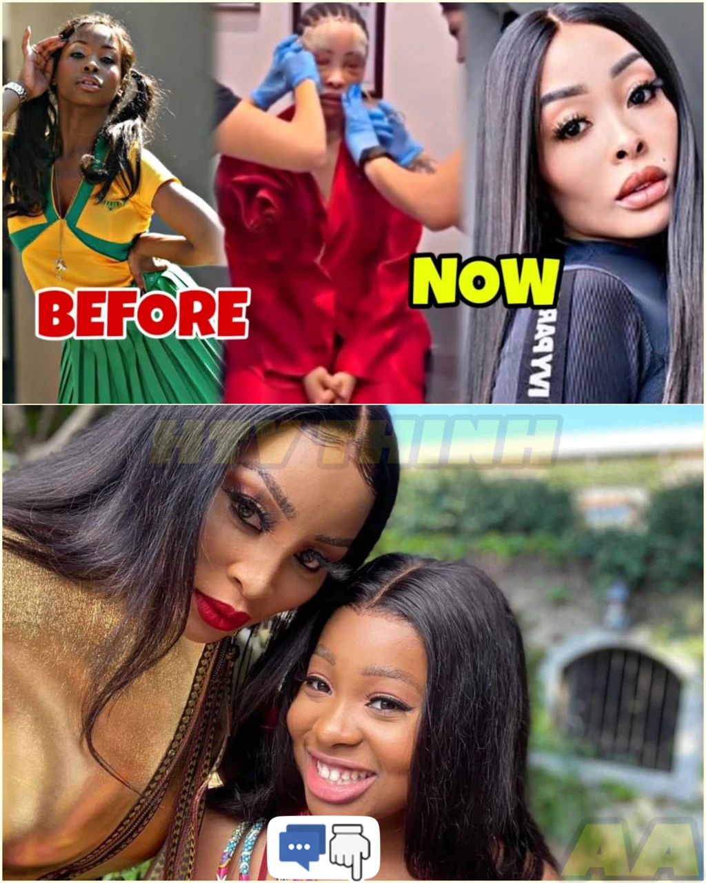 Khanyi Mbau Shocks Fans with New Face Look After Surgery - News