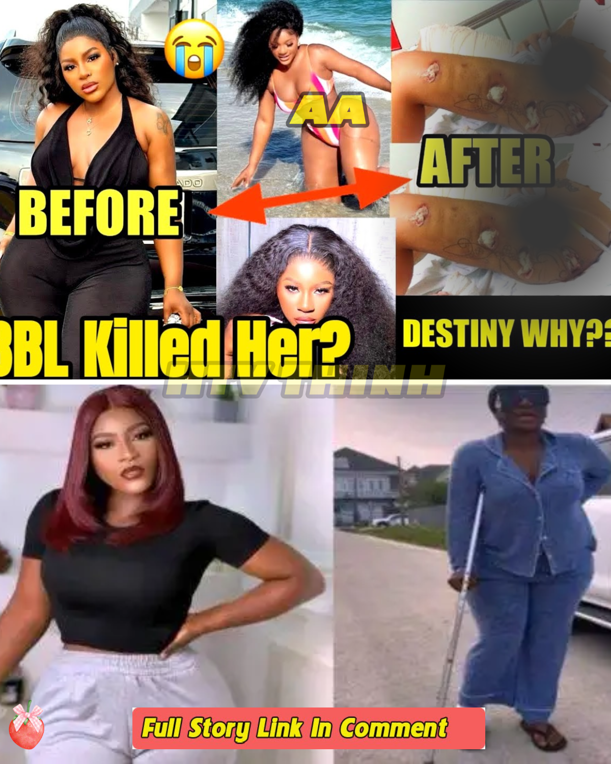 Heartbreaking News: What Really Happened to Destiny Etiko After the Surgery? - News